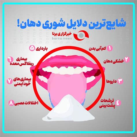 علت اصلی شوری دهان چیست؟ عکس