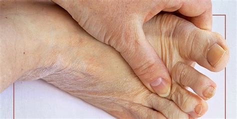 당뇨 합병증 ‘당뇨족이 겨울철에 더 무서운 이유 Mate 팁나눔