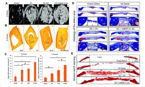 A Micro Ct Shows A Three Dimensional Model Image Of The Defect At 8 Download Scientific