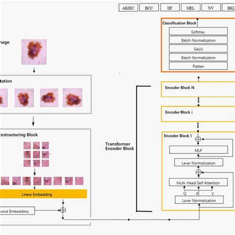The Proposed Vision Transformer For Skin Cancer Detection Vitfscd