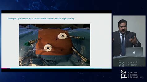 Transperitoneal Partial Nephrectomy Patient Positioning Port Placement And Docking Youtube