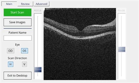 Low Cost Oct User Interface Displaying A Healthy Retina During Clinical