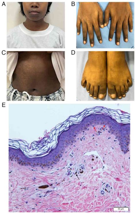 Biomedical Reports