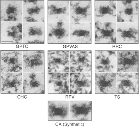Figure 1 From Myosin Filament Structure In Vertebrate Smooth Muscle