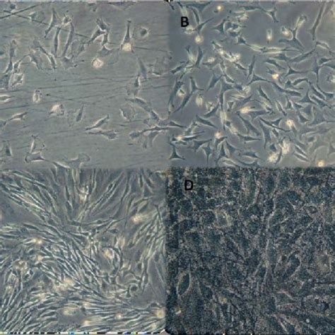 Mononuclear Fraction Formed After Centrifugation On Histopaque