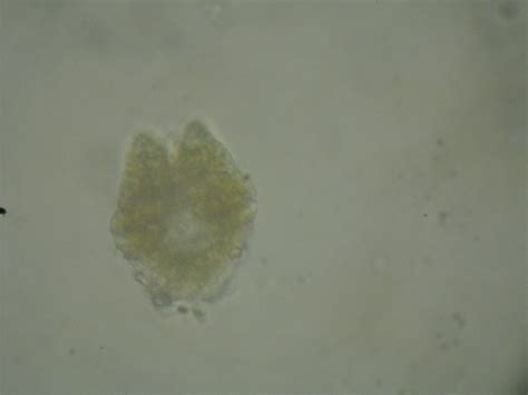 Phytoplankton Identification