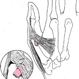 Testing Of The UCL With MCP In Extension Download Scientific Diagram