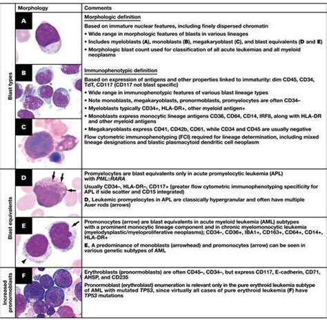 Charles I On Linkedin Guide To The Diagnosis Of Myeloid Neoplasms A