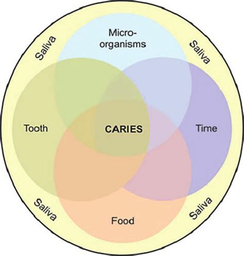 Dental Caries A Multifactorial Disease Download Scientific Diagram
