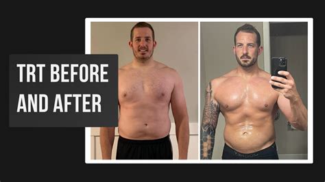 Trt Before And After 3 Impressive Transformations Alynmd