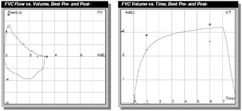 Lung Function Test Texas Allergy Group Houston Allergist Immunologist