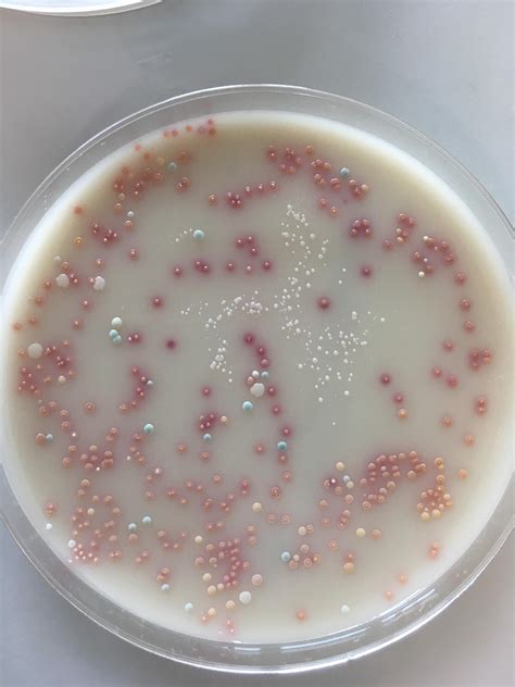 Bakteri Staphylococcus Kuman Foto Gratis Di Pixabay Pixabay