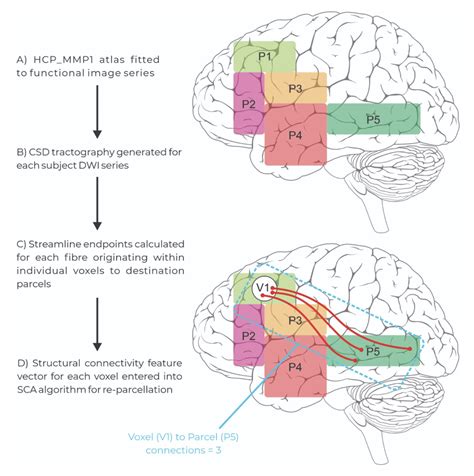 How We Build Personalized Brain Maps