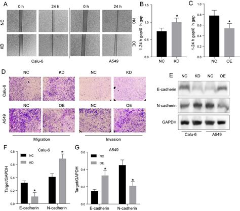 Downregulation Of Slc14a1 Expression Indicates Poor Prognosis And