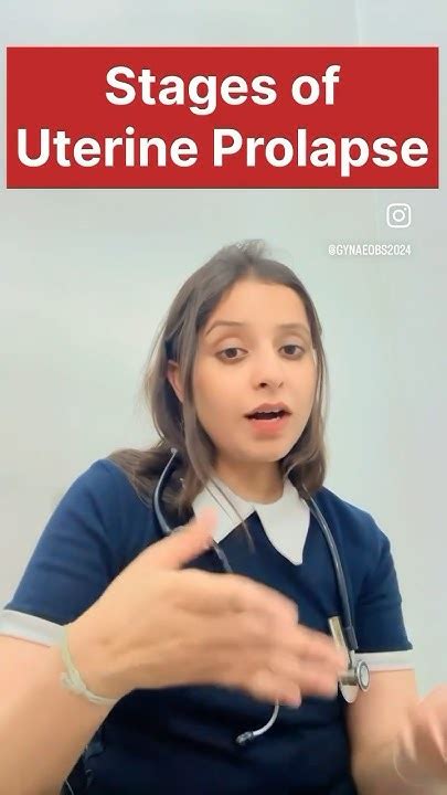 Uterine Prolapse Stages Uterus Doctor Gynaeyoutubeshorts