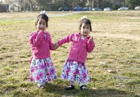 The Sabuko Sisters Are Siamese Twins Who Were Successfully Separated