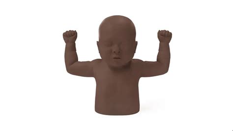 Infant Hip Exam Upper Dark Adamrouilly