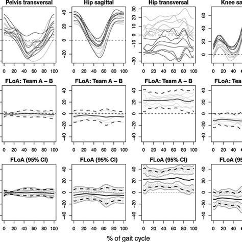 A Tibial Torsion Measured By Physical Examination Of Bimalleolar Axis