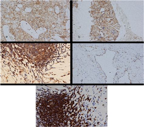 A St2 Immuno Reactivity In Macrophages With An Evident Membrane