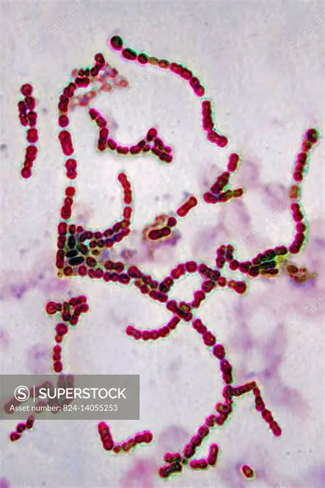 Streptococcus Pyogenes Gram Stain
