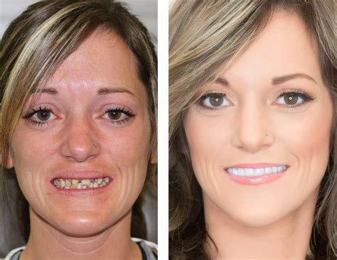 All County Oral And Maxillofacial Surgery Dental Implant Specialists At