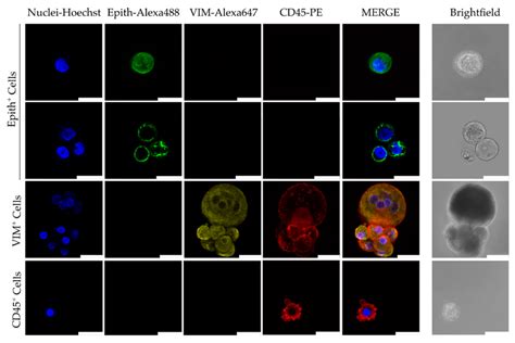 Representative Images By Confocal Microscopy Of Immunofluorescence Download Scientific Diagram