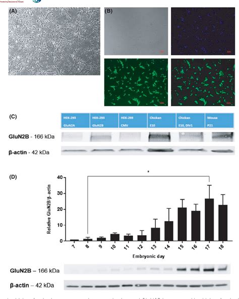 figure 2 from exploring the overlapping binding sites of ifenprodil and