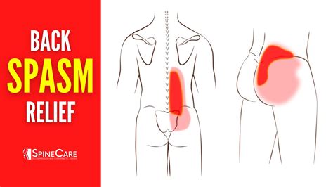 How To Get Rid Of Lower Back Spasms And Muscle Knots Instant Relief Youtube