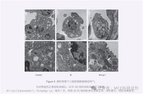 科学网—铁死亡标志：细胞形态变化、代谢改变、分子特征与程序性死亡比较 Mce 蒲姣姣的博文