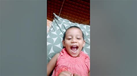 গালে একটা দাগ ওটা কিসের দাগ Shorts Video Viralvideo Viralshorts