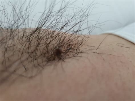 뽐뿌 혐주의 겨드랑이 쥐젖같은거 어찌 없애나요