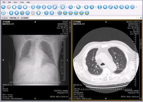 Window Leveling Definition Radiology At Alan Koester Blog
