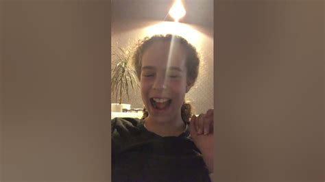 Im Sorry But Why Does My Side Profile Look Like Hyperpigmentation 😭