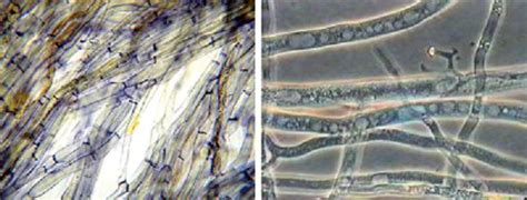 Microscopia De Setas Las Hifas