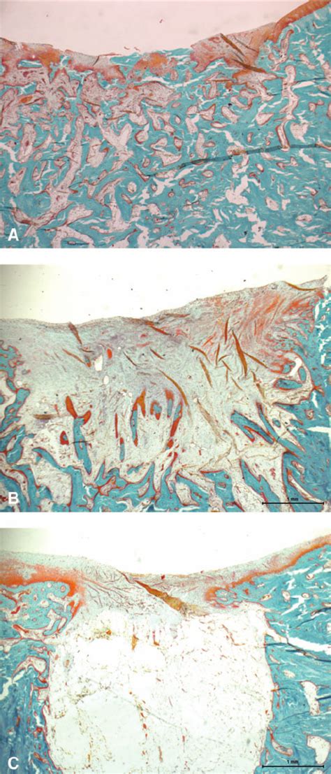 Three Dimensional Reconstructions Of Microcomputed Tomography Scans Download Scientific