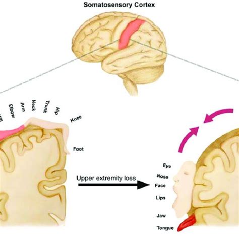 Schematic Illustration Of Cortical Reorganization Following Amputation