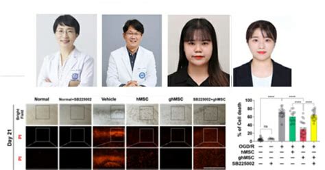 서울대 뇌경색 후유증 줄기세포 치료제 첫 개발