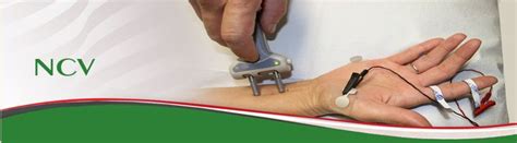 Bera Test In Delhi By Shivam Diagnostics Centre Nerve Normal Body