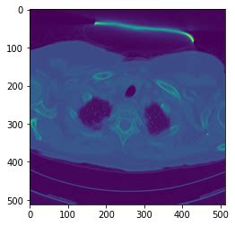Easy PyTorch To Load Image And Volume From Folder