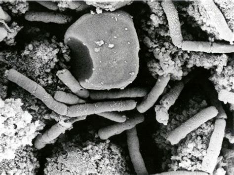 Us Anthrax Scare 86 People Possibly Exposed To Deadly Bacteria After