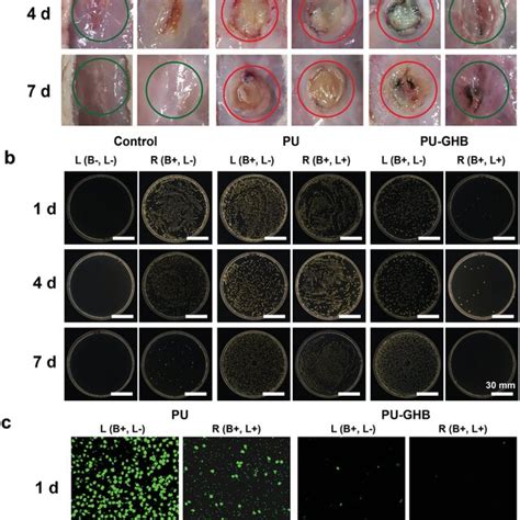 Antibacterial Analysis A Bacterial Colony Counting And B The
