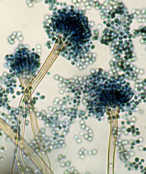 Aspergillus Mycology Online Fungi Art Microscopic Photography Patterns In Nature
