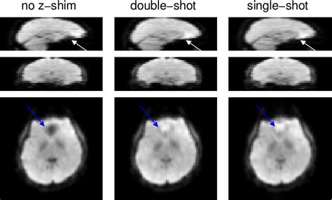 Comparison Of Combined Analysis Images Download Scientific Diagram