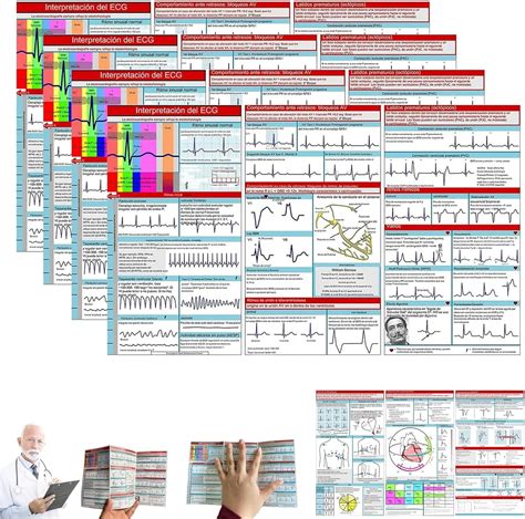 Ekg Pocket Guide Ekg Rhythm Interpretationdouble Sided Compact