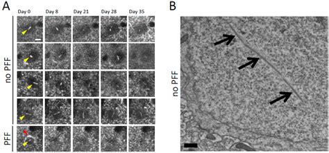 Intranuclear Alpha Synuclein Gfp Rod Like Aggregates Form Spontaneously