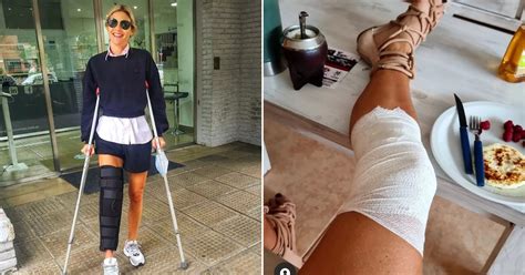 Pía Slapka Tuvo Que Ser Operada Tras Lesionarse En Un Picadito De