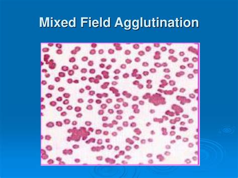 What Causes Mixed Field Agglutination Elaci