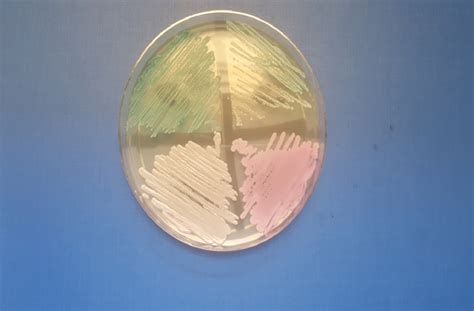 Different Colors Of Colony And Morphologies Of Various Candida Species