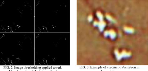 Figure 1 From Robust Specular Reflection Removal And Visibility Enhancement Of Endoscopic Images
