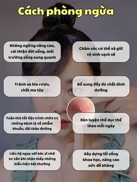 MỤn Áp Xe VÀ NhỮng ĐiỀu CẦn BiẾt Bộ Sưu Tập Do Bảo Bối 🍀 đăng Lemon8